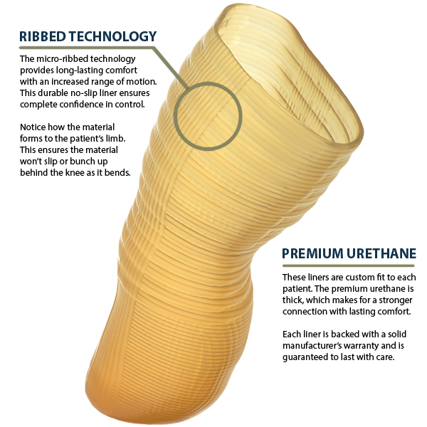 EMS "Enhanced Mobility Socket" | (855) 654-0858 | Prosthetics